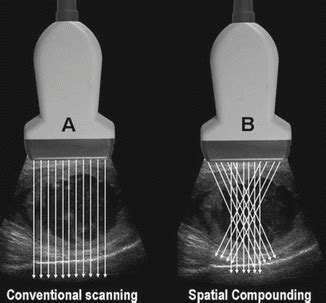 Penile Ultrasound Radiology Key
