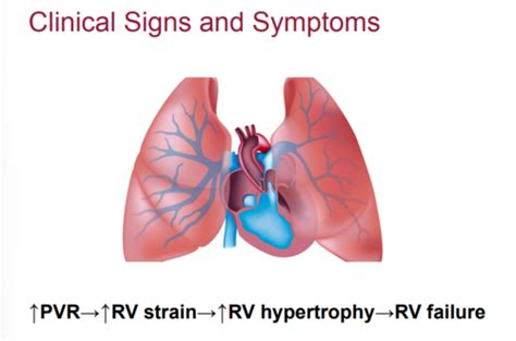 Pulmonary Htn Flashcards Quizlet