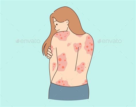 Unhealthy Woman Show Red Rash On Back Vectors Graphicriver