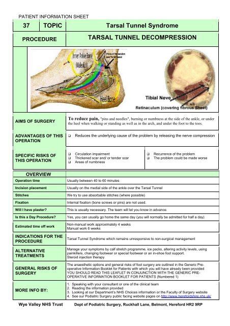 37 Tarsal Tunnel Syndrome Decompression Herefordshire Nhs