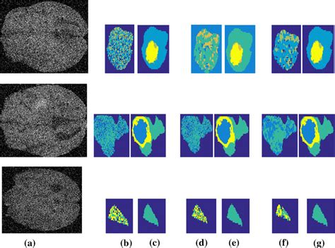 Segmentation Of Simulated Brain Mr Image A Original Input Mr Images C