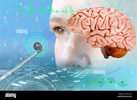 Electronic Chip Bug In Scientist S Hand Successful Implantation Of Wireless Chip Into Human