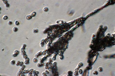 푸른곰팡이 이로운점 해로운점 네이버 블로그