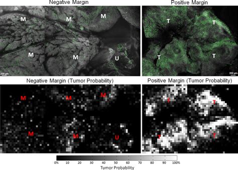 Full Margin Images Acquired With The SIM System Representative Images Download Scientific