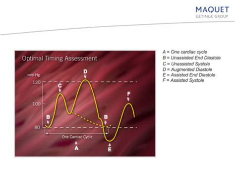 Iabp Flashcards Quizlet