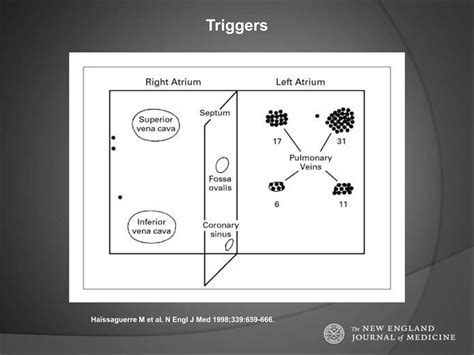 Atrial Fibrillation Finalpptatrial Fibrillation Fina Ppt