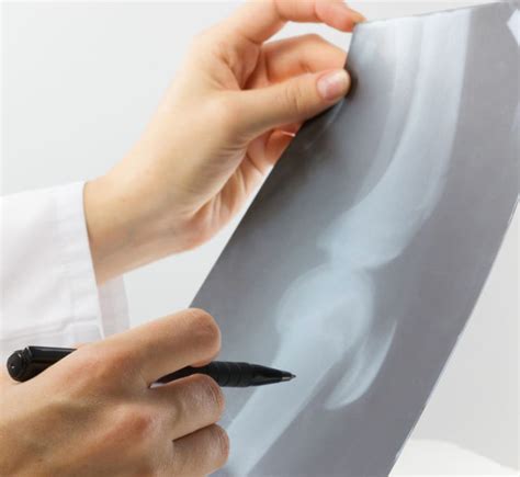 Traumatologia Amot Assistência Médica