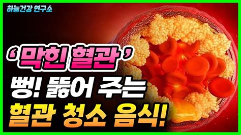 막힌 혈관 뻥 뚫어주는 혈관청소 방법 총 정리 혈관에좋은음식 혈관건강 확인법 Youtube