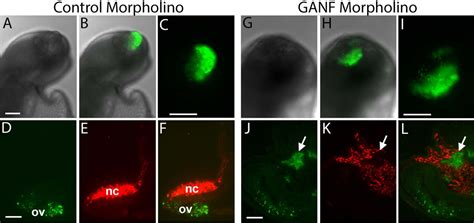 Stage Dependent Plasticity Of The Anterior Neural Folds To Form Olfactory Placode Versus Neural