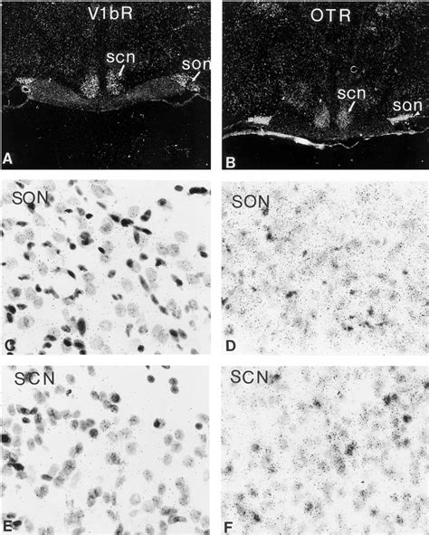 Supraoptic And Suprachiasmatic Nuclei Of The Hypothalamus V1br Left Download Scientific