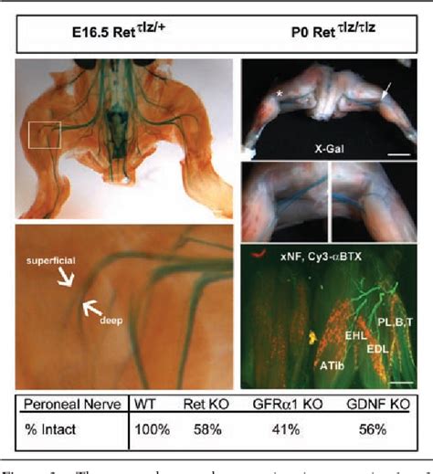Figure 3 From Neurotrophic Modulation Of Motor Neuron Development Semantic Scholar