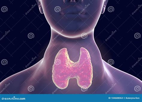 Toxic Diffuse Goiter Stock Illustration 104687950