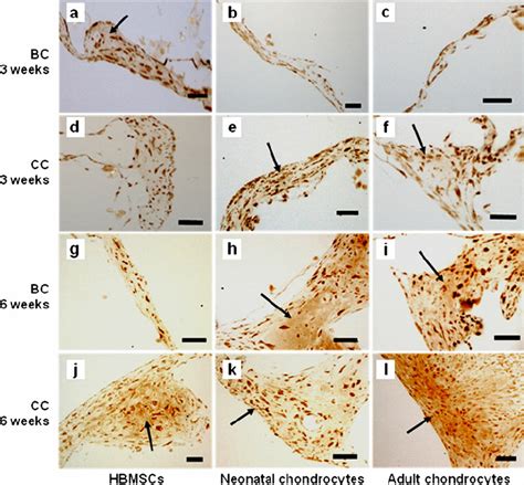 Aggrecan Immunohistochemical Staining Of In Vitro Statically Cultured