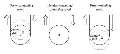 Three Scenarios Of Synchronization Between Extending And Contracting