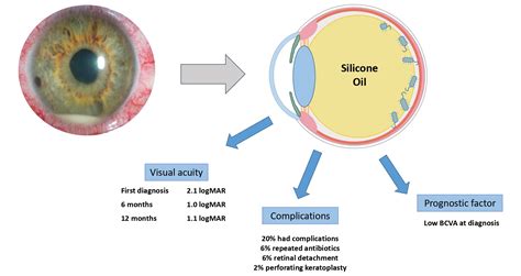 Intravitreal Injection Endophthalmitis