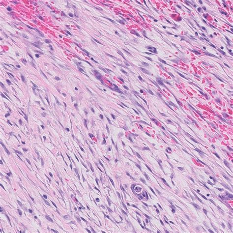 ubc normal patches 500x500 kaggle