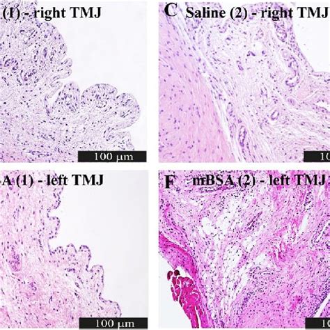 Photomicrographs Of The Tmj Synovial Membrane A Normal Tmj Synovial Download Scientific
