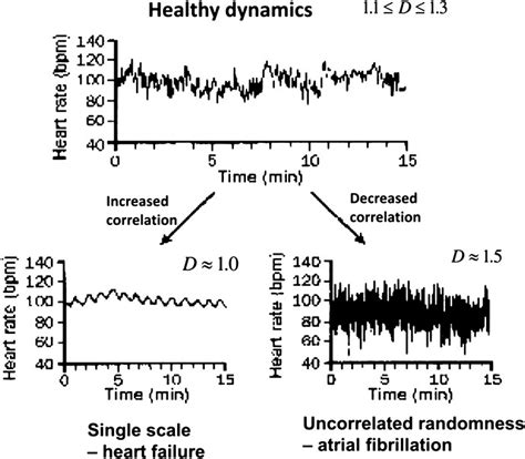 A Typical Heart Rate Time Series With A Fractal Dimension In The