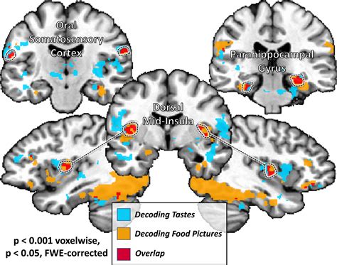 Insular Cortex Fmri