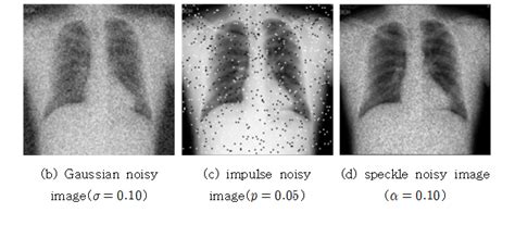 Github Eonseungseongimage Denoising With Cddae Convolutional Dual