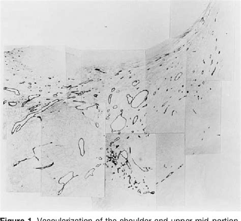 Figure 1 From Angiogenesis And Pericytes In The Initiation Of Ectopic Calcification Semantic