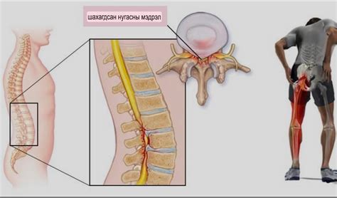 Маралгоо Уламжлалт Эмчилгээ Аарцаг Нурууны Бариа Заслын Төв ⁉️ БАГА ЗЭРЭГ АЛХААД Л ХӨЛ