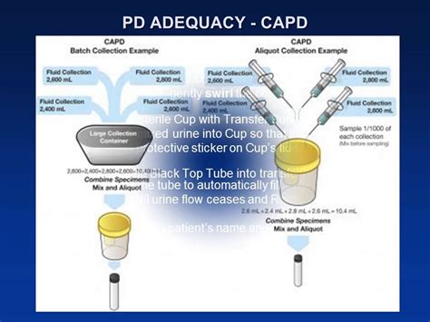 Peritoneal Fluid Collection Ultrasound In Abdominal Emergencies