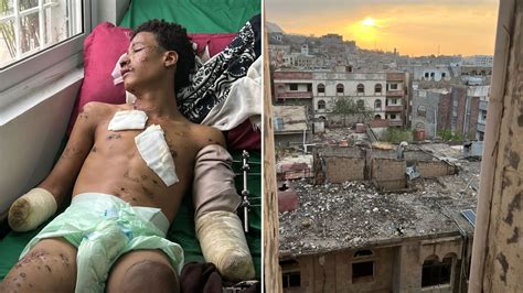 Yemen Amid Hopes For Peace The Maimed Starving And Oppressed Victims