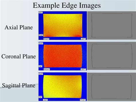 Ppt Software Development For Correction Of Gradient Nonlinearity