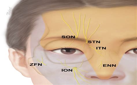 Emerging Points Of The Supraorbital And Supratrochlear Nerve Dermatologic Surgery