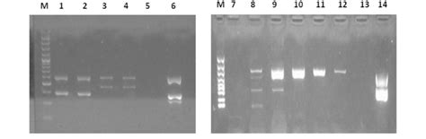 Multiplex Pcr Of Bcr Abl1 Transcript Variants In Cml Patients