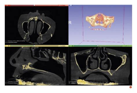a segmentation of dicom data and b 3d image generated after