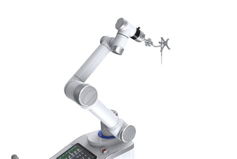 What Are The Obvious Advantages Of Spine Surgery Robot Assisted Minimally Invasive Surgery Over