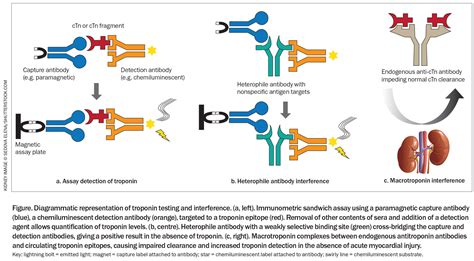 False Positive Cardiac Troponin In Clinical Practice Causes