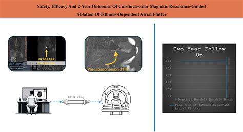 Safety Efficacy And 2 Year Outcomes Of Cardiovascular Magnetic