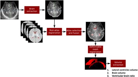 Overview Of The Lateral Ventricular Segmentation Method Boucher Et Al Download Scientific