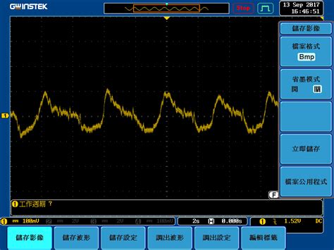 Accelerometer And Respiration Stmicroelectronics Community