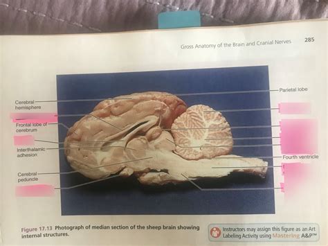Labeling Median Section Sheep Brain Diagram Quizlet