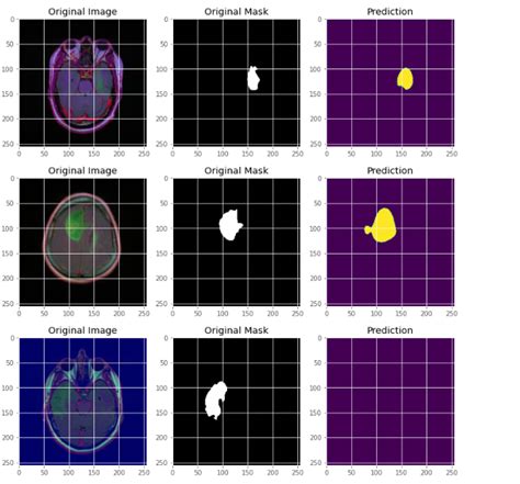 segmentation results of the fcn architecture download scientific diagram