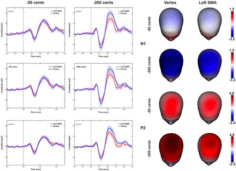 Left Panel Grand Averaged Erp Waveforms In Response To Pitch