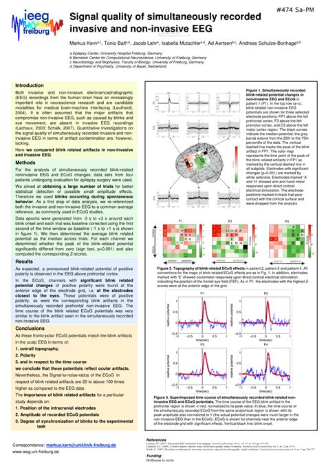 Pdf Signal Quality Of Simultaneously Recorded Invasive And Non