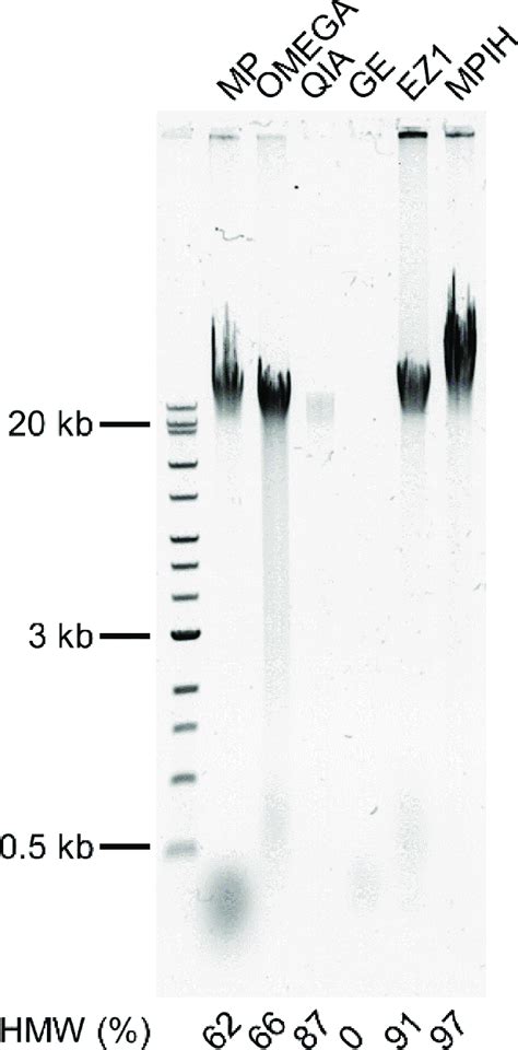 DNA Fragment Length Results For The Six Extraction Methods With 0 5 Download Scientific