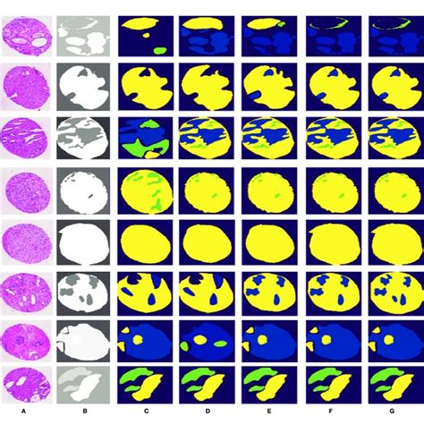Different Segmentation Results From Fcn Segnet U Net Deeplabv3 Download Scientific