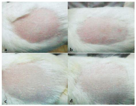 Biocompatible Hydrogel Coating On Silicone Rubber With Improved