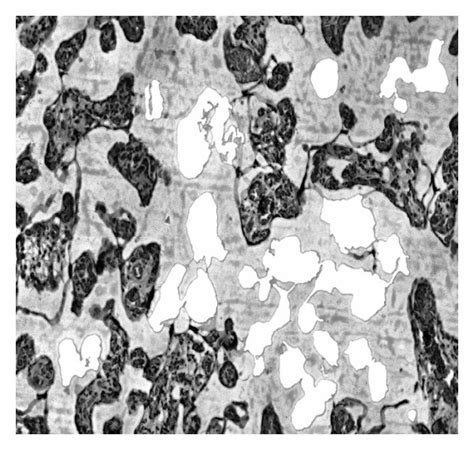 A Binary Image Obtained By Otsus Thresholding B Superimposing The
