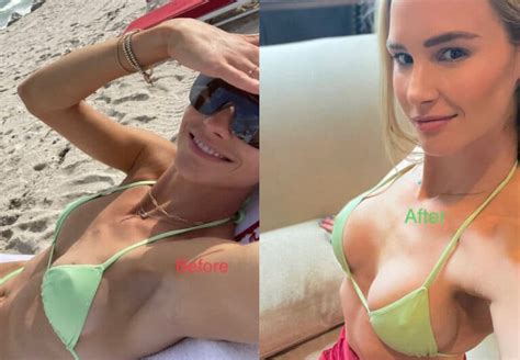 Rhoc See Meghan King S Before And After Breast Implants Pic