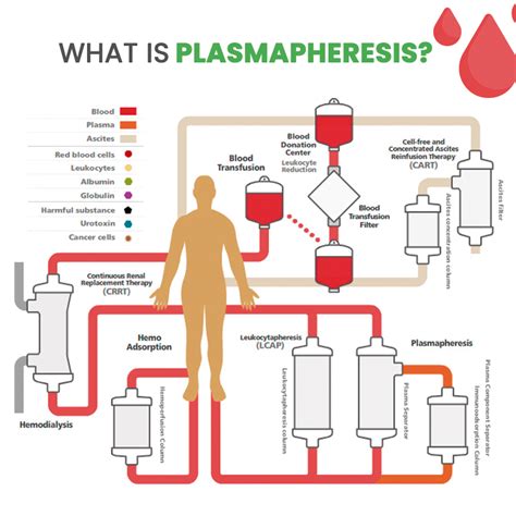Plasmapheresis Process