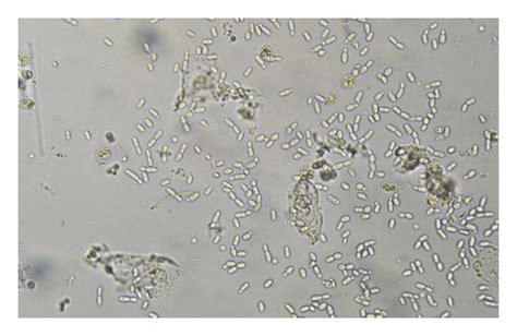 Different Types Of Microscopic Leucorrhea Images A Normal Negative