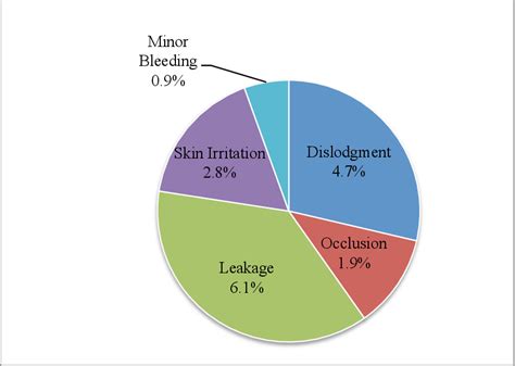 Figure 1 From Continuous Thoracic Paravertebral Nerve Blocks In Pediatric Patients Semantic