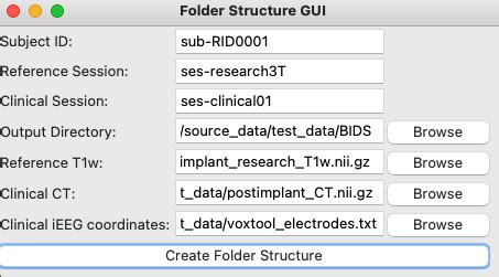 Running The App Ieeg Recon Documentation
